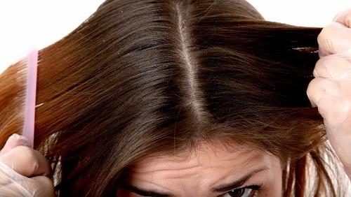 Rimedi naturali per i capelli grassi - Guide - GreenStyle