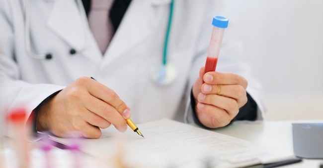 Ematocrito (Ht o HCT): cos'è e valori normali - GreenStyle