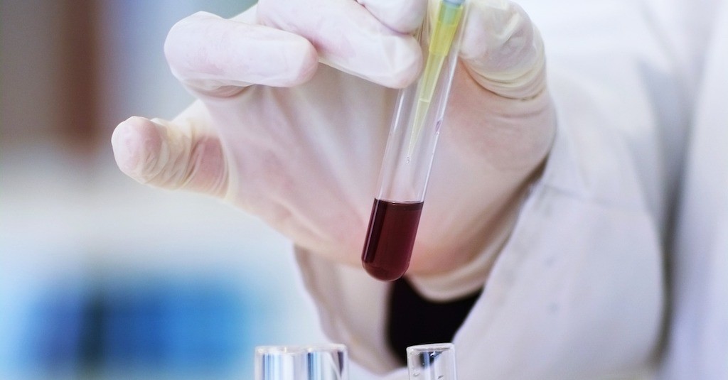 VES alta e bassa: quando preoccuparsi? - GreenStyle