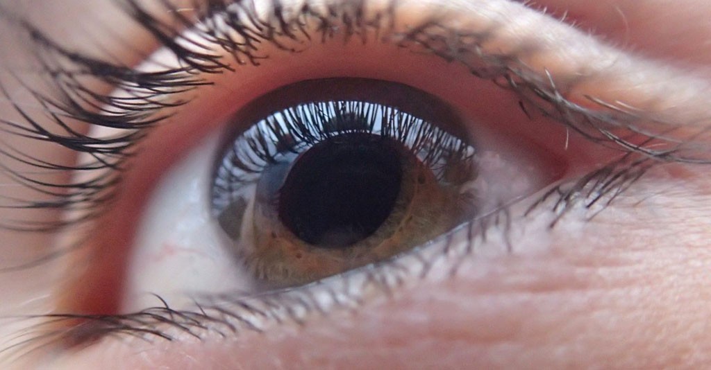 Pupille dilatate: rimedi naturali - GreenStyle