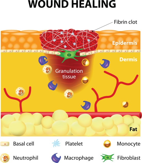 Monociti bassi o alti? I valori di riferimento e quando preoccuparsi ...