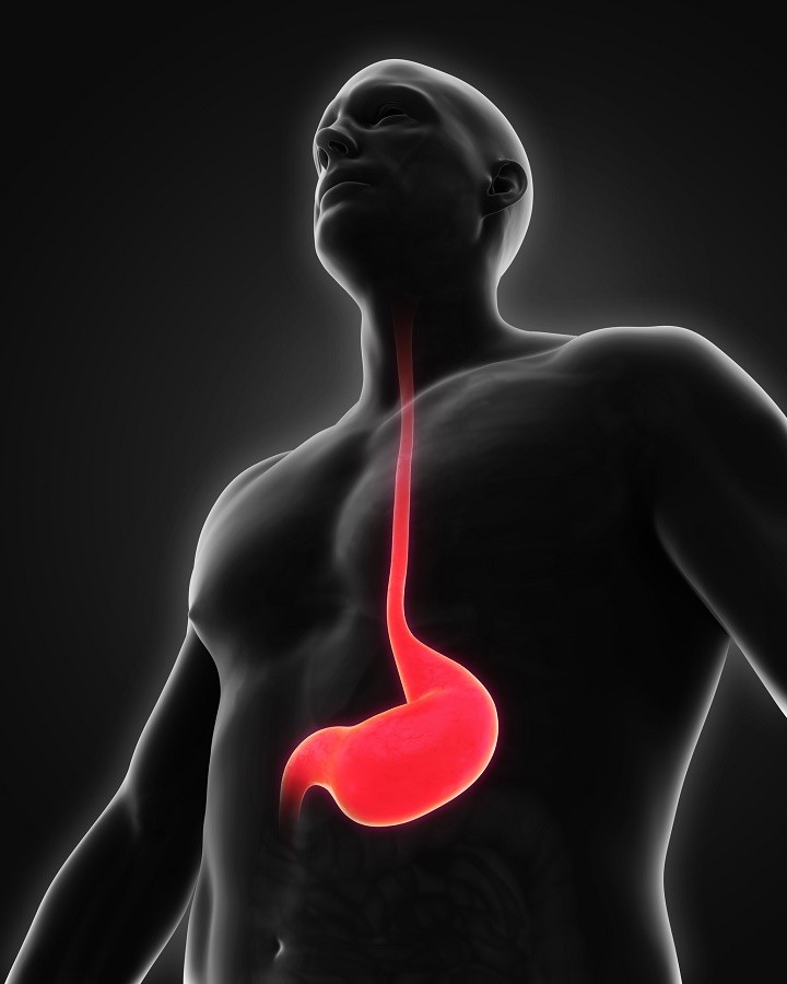 Cancro all'esofago: sintomi, cause e cure - Benessereblog