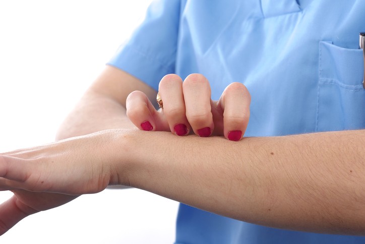 Dermatite allergica: sintomi, cure e fattori di rischio - Benessereblog