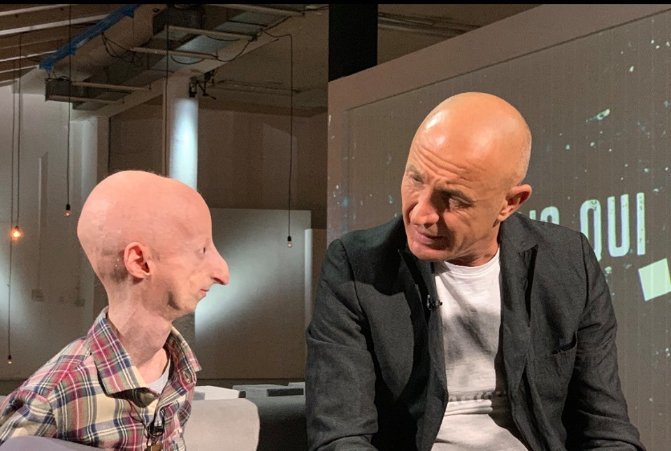 Sammy Basso parla di progeria a Che ci faccio qui - Benessereblog